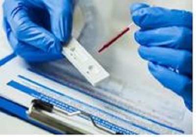 UFC-Que Choisir de l'Artois – Covid-19 : faut-il passer un test ...